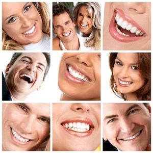 Ultima Laser Teeth Whitening Oxford - Ultimate Smiles Tooth Whitening